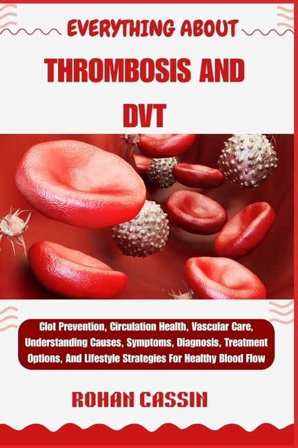 Everything about Thrombosis and Dvt: Clot Prevention, Circulation ...
