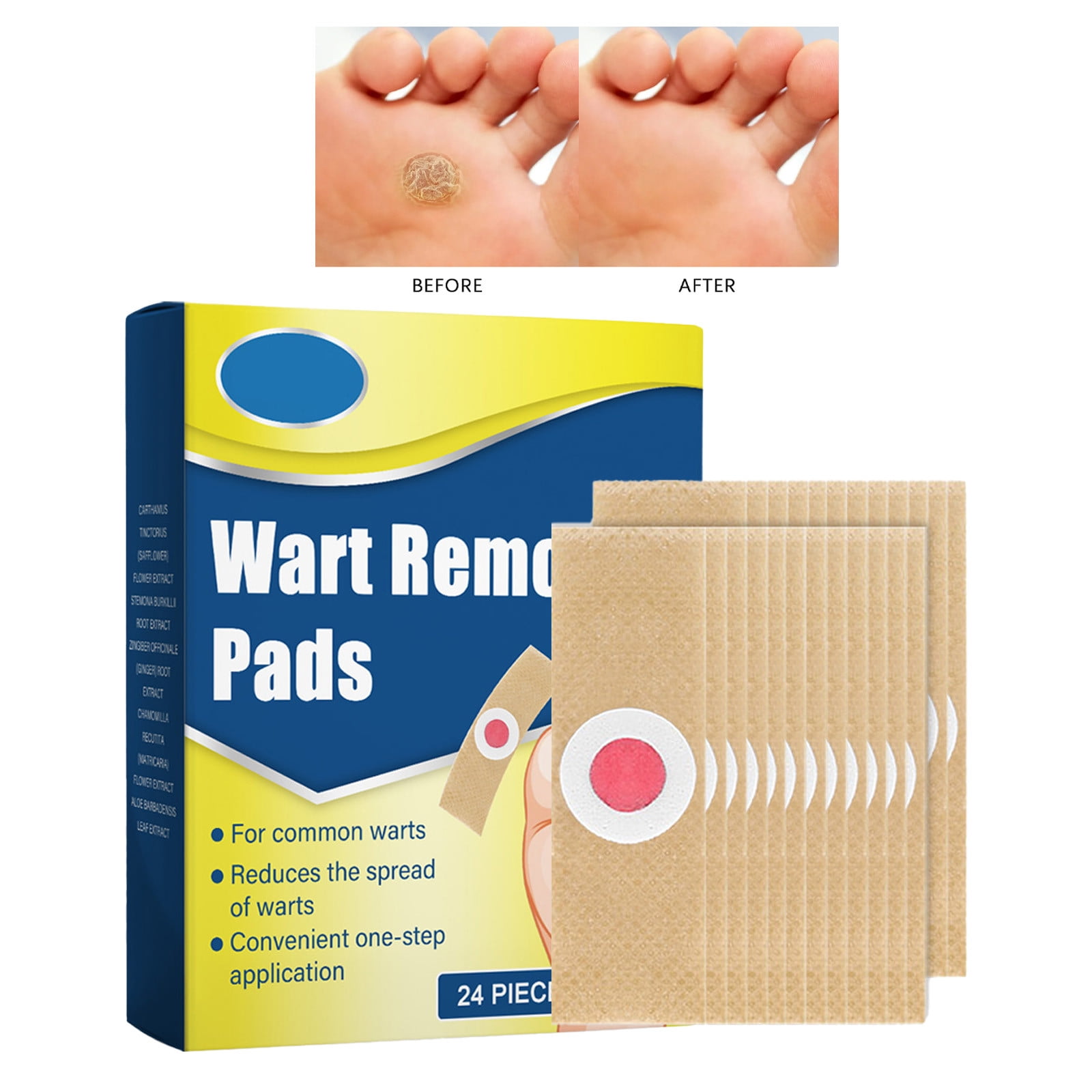 Exfoliating＆Anti Aging Moisturizing＆Hydrating Wart Remover Wart Remover ...