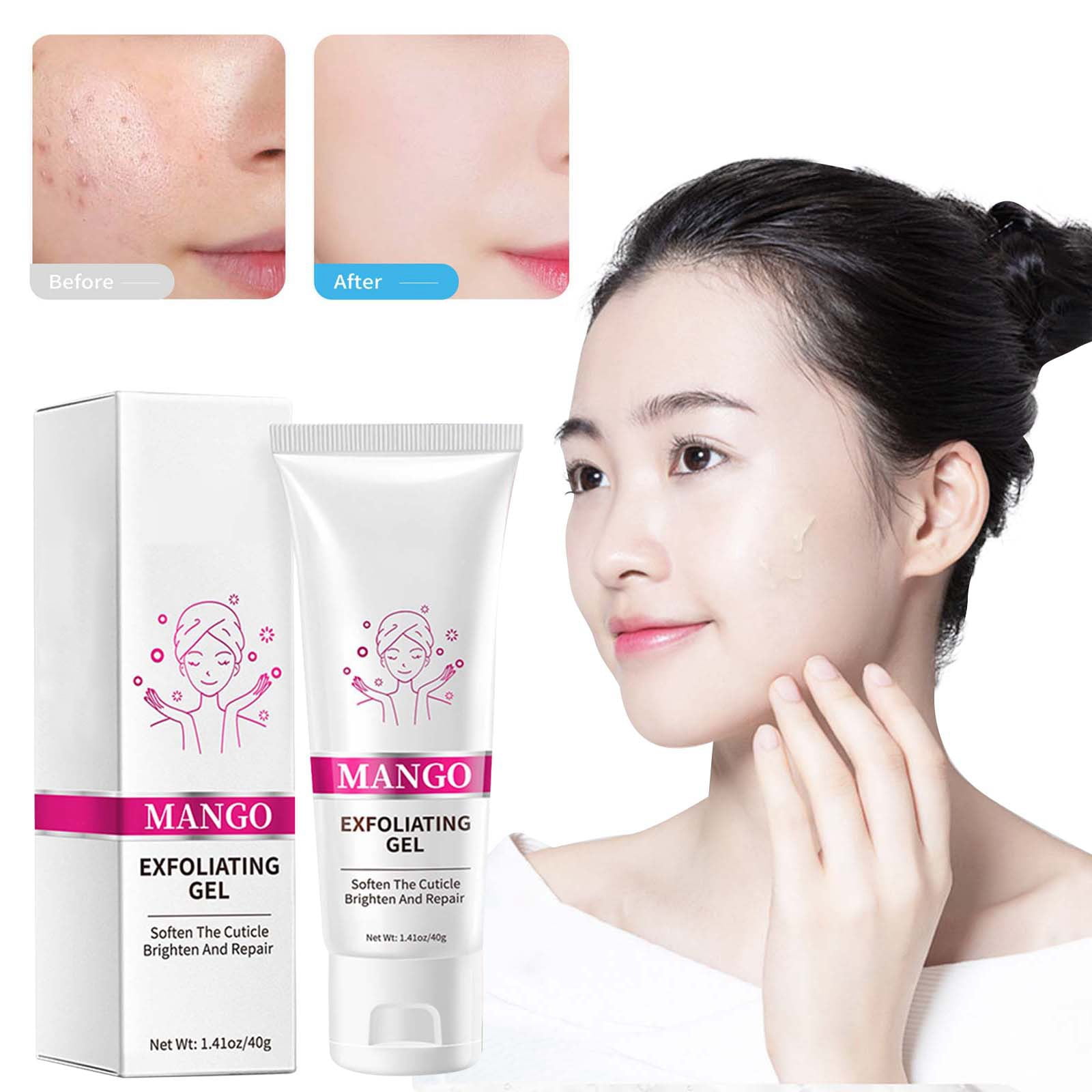 Exfoliating Facial Cleansing To Dead Skin Cells Softening Dead Skin Gel ...