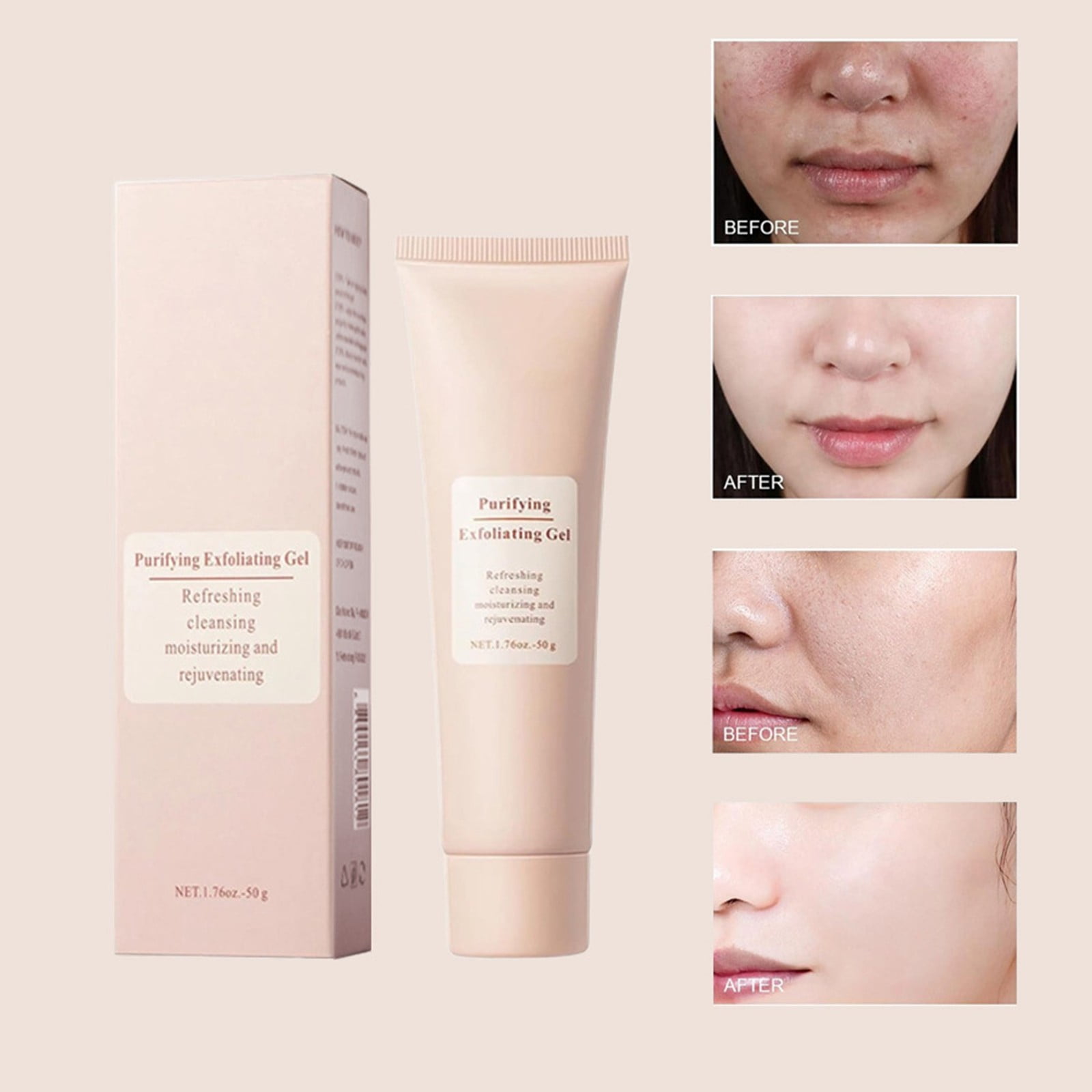 Exfoliating Gel For Deep Cleansing And Unclogging Pores Dead Skin Cells ...