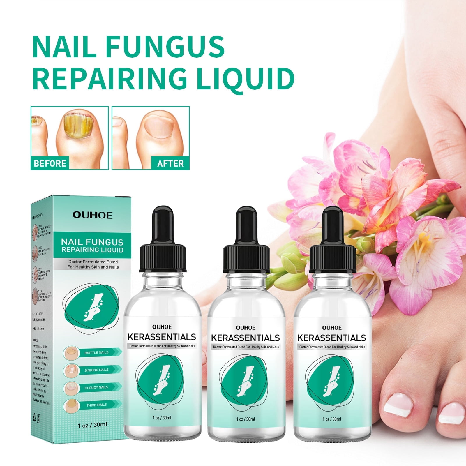 Extra Strength Toenail Fungus Treatment For Toenail Or Fingernail, Nail ...