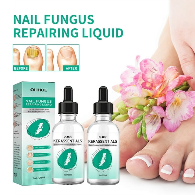 Extra Strength Toenail Fungus Treatment For Toenail Or Fingernail ...