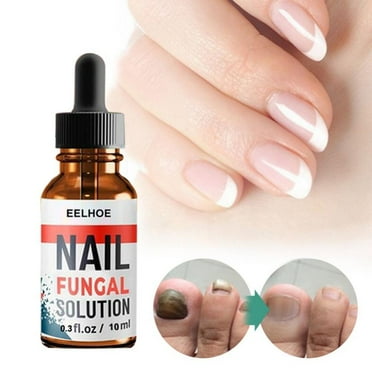 Nail Fungus Treatment Toenail and Finger Anti-Fungal for Discolored or ...