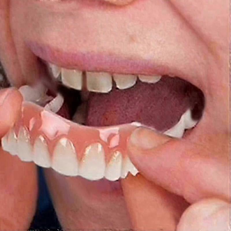 Extra Thin Fake Bright White Tooth Veneers Silicone Soft Safe Adhesive ...