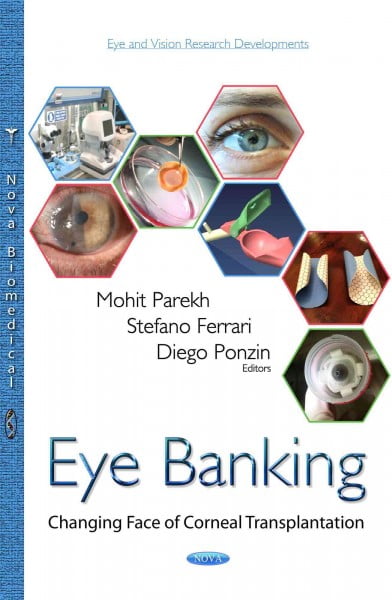 Eye Banking : Changing Face of Corneal Transplantation - Walmart.com