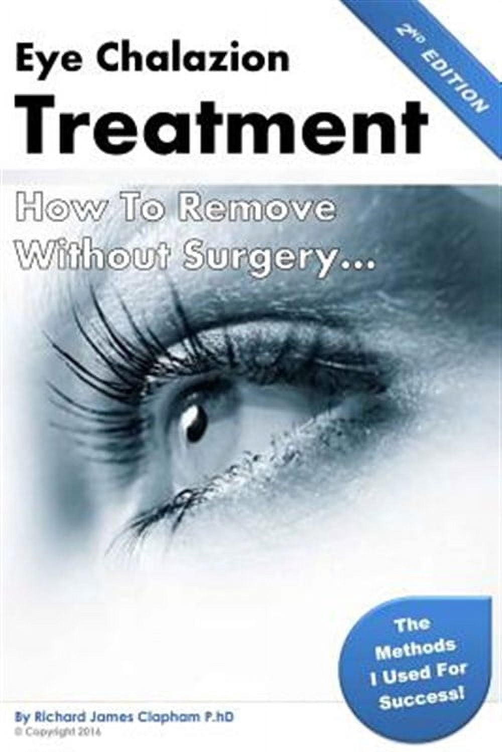 Eye Chalazion : How to Remove Without Surgery - Walmart.com