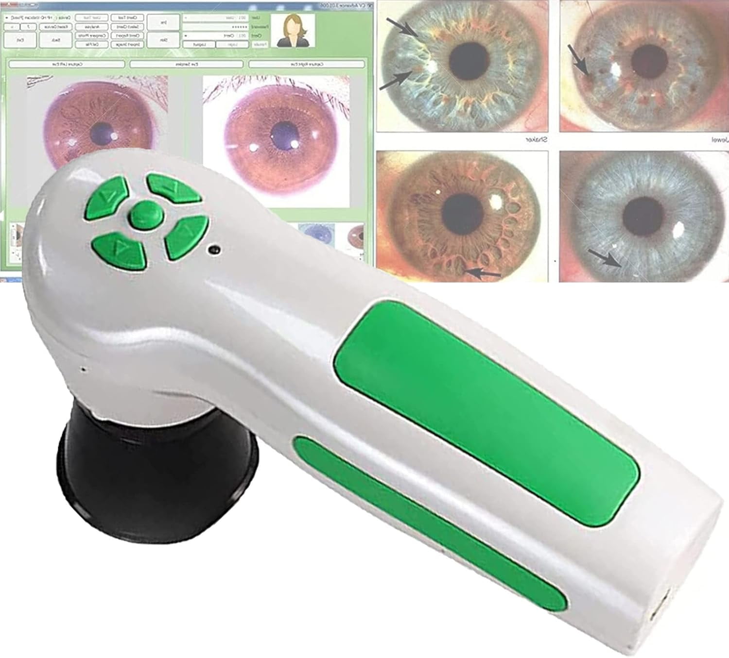 Eye Iridology Camera, Iris Analysis Camera, 12MP High Resolution USB ...