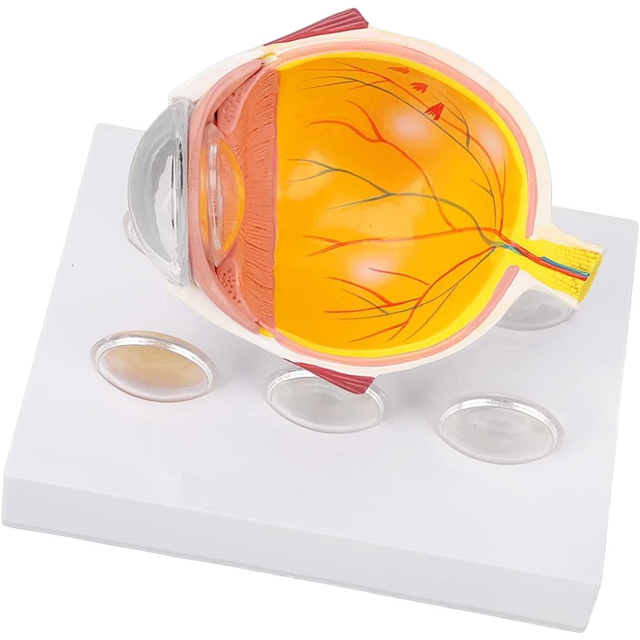 Eyeball Lesion Model,Eye Anatomical Model,Enlarged Human Eye Anatomical ...