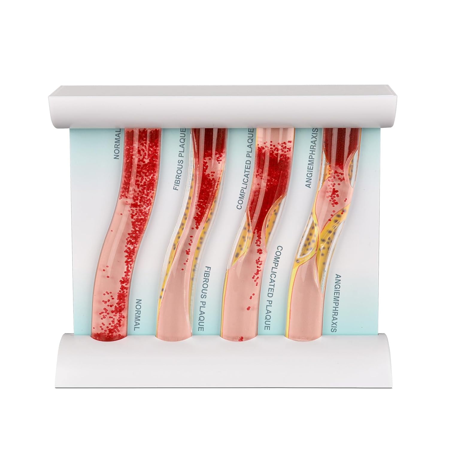 Eztrain Low-Density Lipoprotein LDL Blood Vessel Model for Medical ...