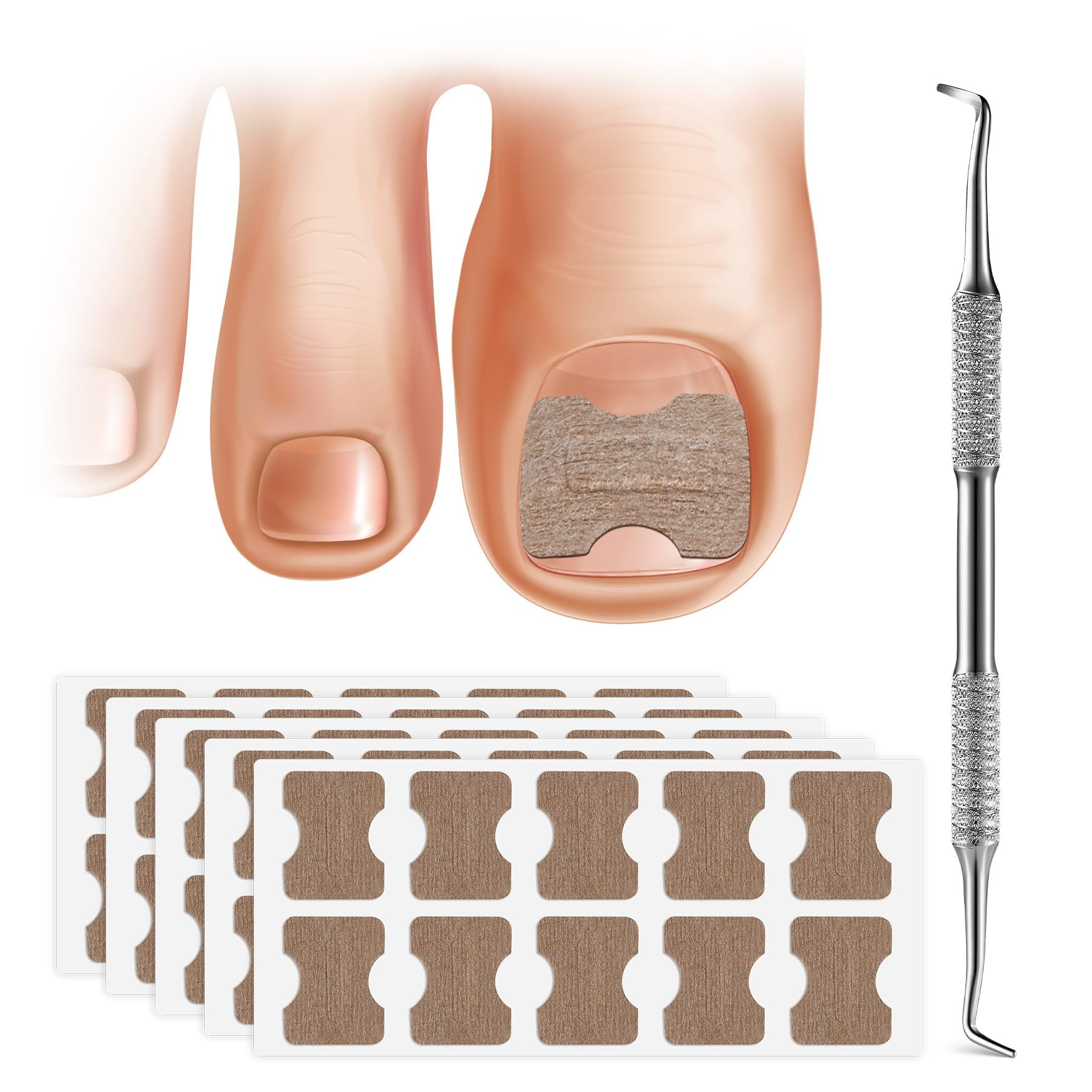 FERYES 50 PCS Breathable Ingrown Toenail Corrector Patch with Double ...