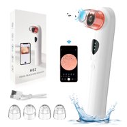 Blackhead Remover Vacuum,Upgraded WiFi Visible Facial Pore Cleanser with HD Camera Pimple Acne ...
