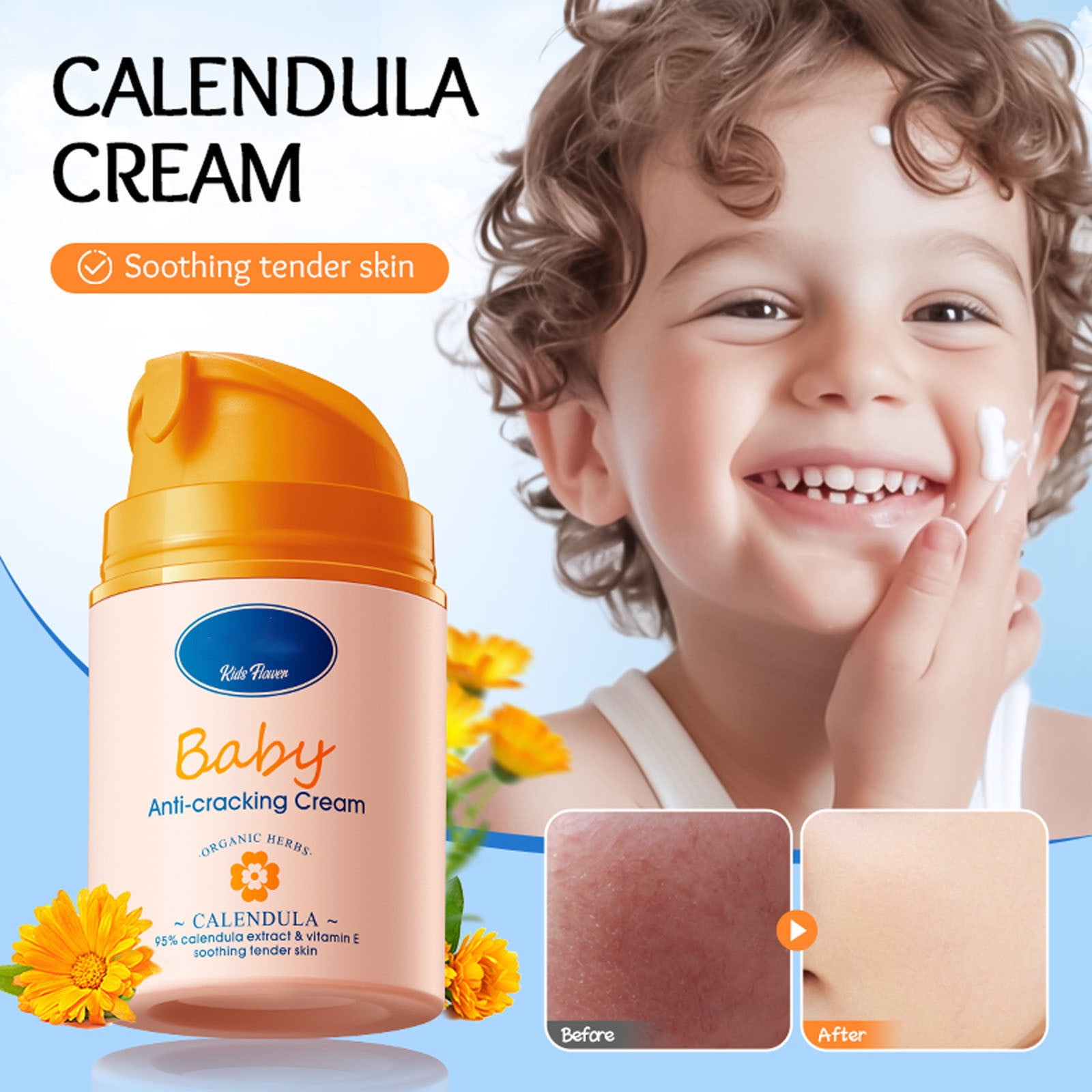 Face Cream Moisturizing Calendula And Vitamin E Infused Cream Gentle Formula Soothes Dry Skin ...