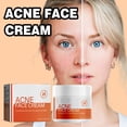Face Moisturizers For Stubborn Pimple Blackhead Face Dots Natural For ...
