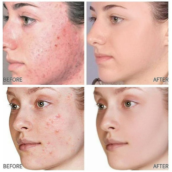 Retinol Collagen Hyaluronic Acid