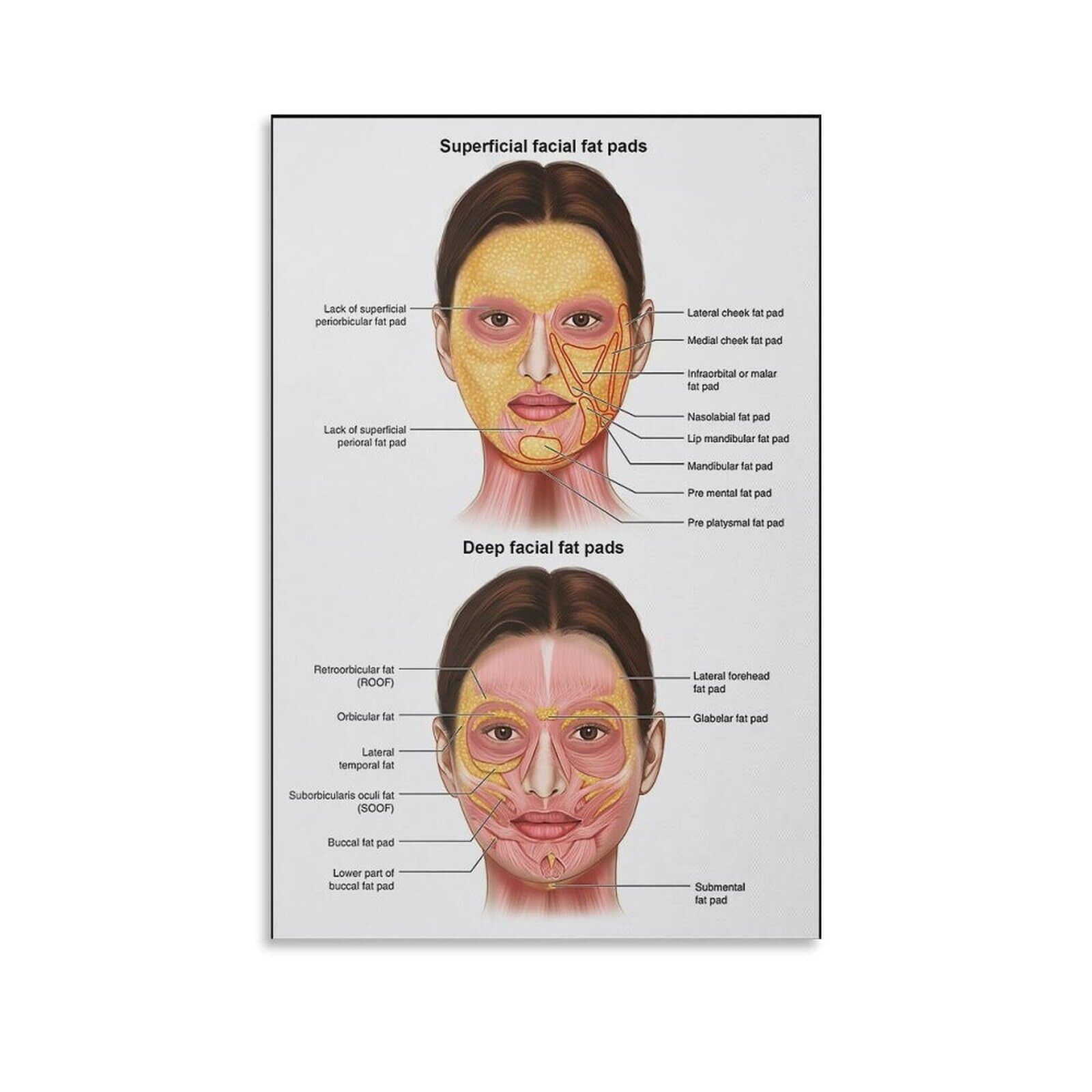 Facial Fat Pads Poster Face Anatomy Esthetician Plastic Medical ...