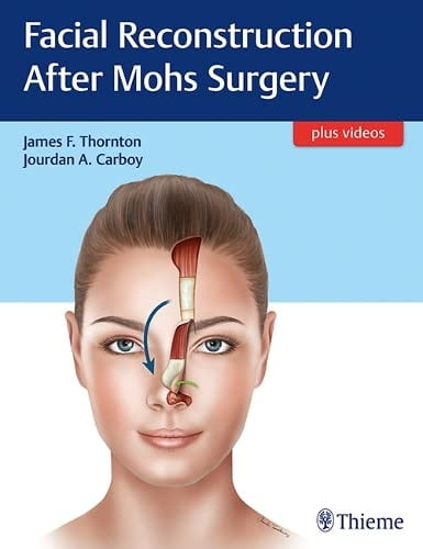 Pre-Owned Facial Reconstruction After Mohs Surgery [Hardcover] Thornton ...