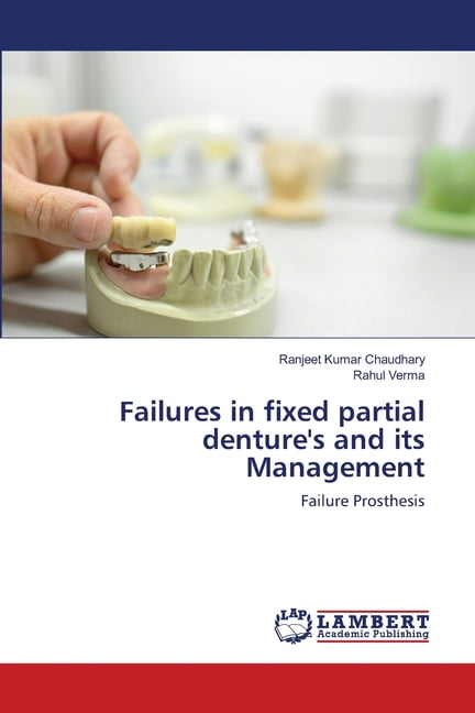 Failures in fixed partial denture's and its Management (Paperback ...