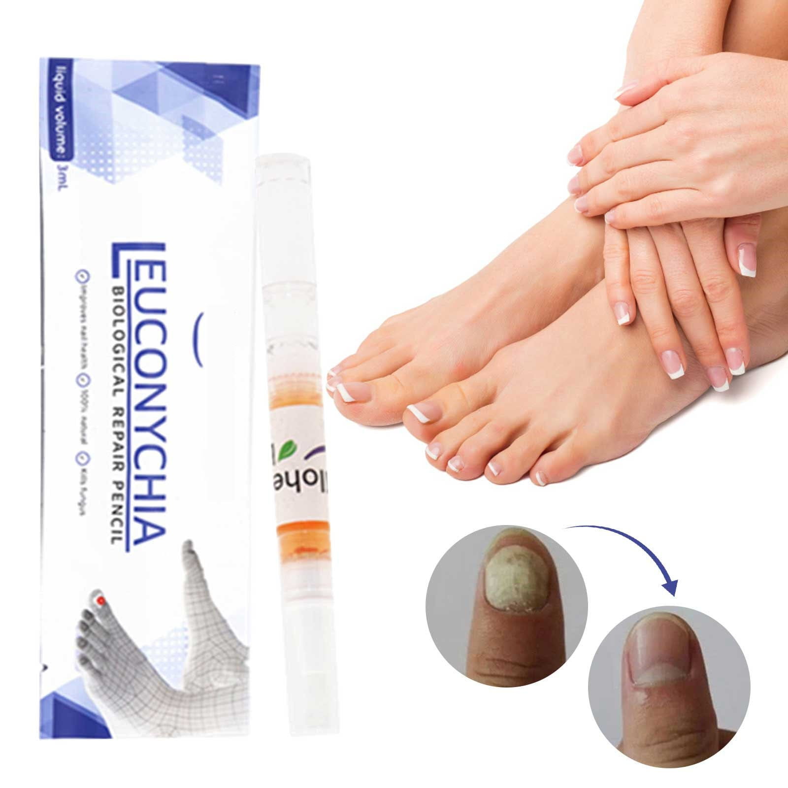 Fall Nail Care Nail Pens For Toenail And Fingernail Maximum Strength ...