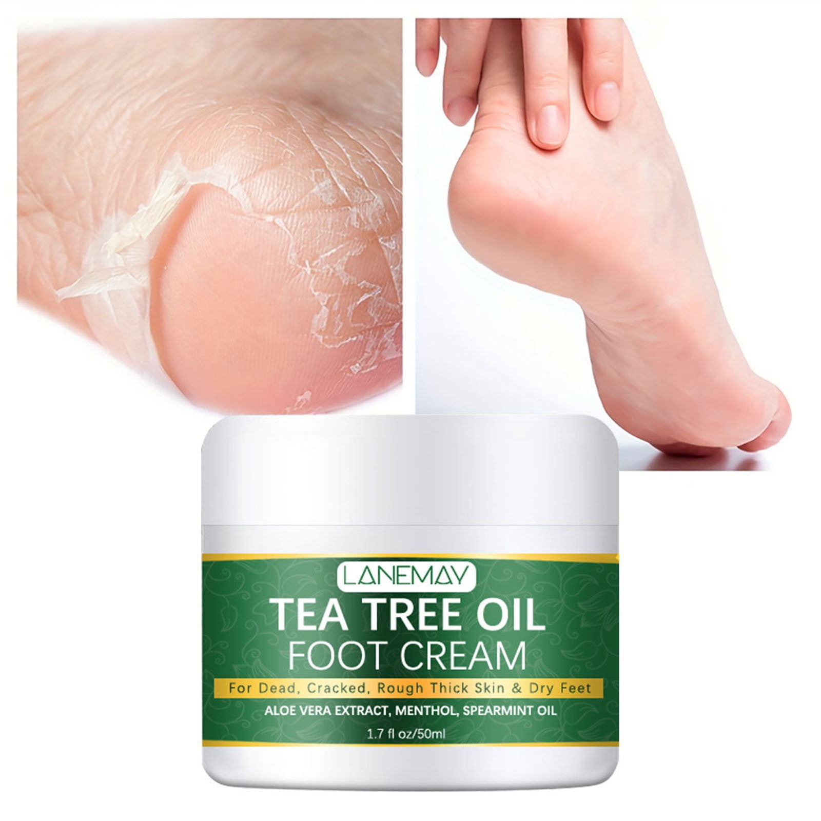 Fankiway Foot Cream for Dry Cracked Heels and Feet, Moisturizing Foot ...