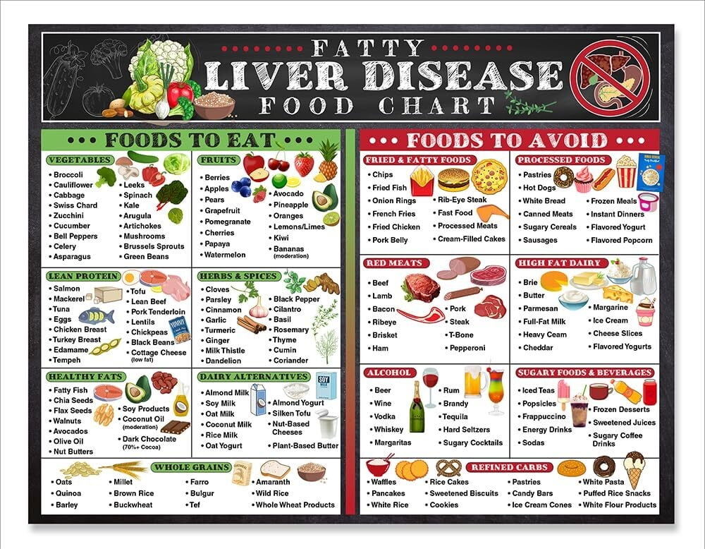 Fatty Liver Disease Food Chart Poster Liver Health Nutrition Guide, Low ...