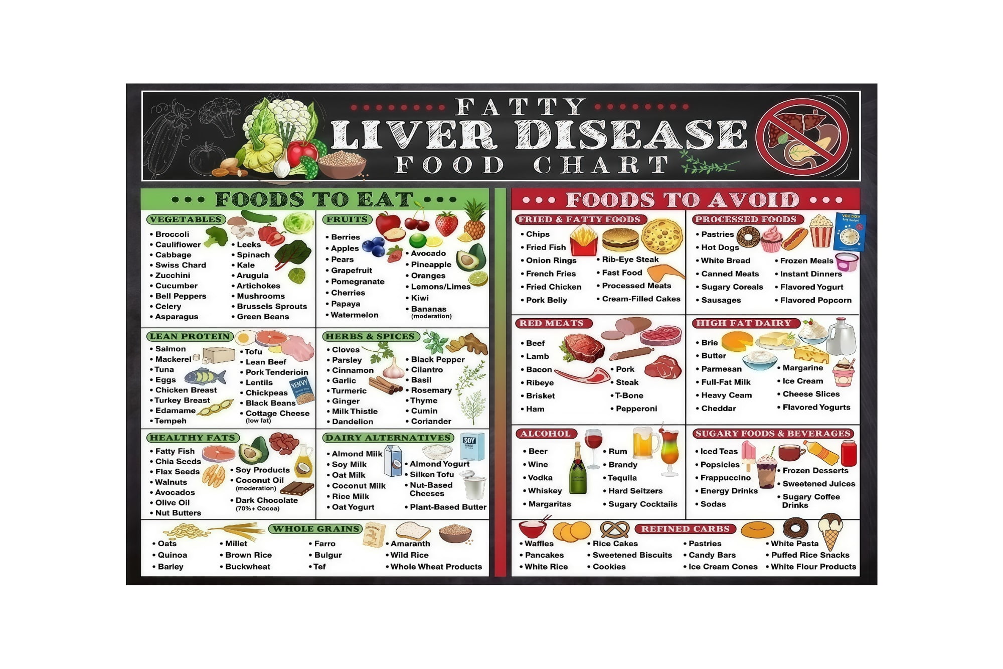 Fatty Liver Food Chart Poster Grocery List Reference Educational ...