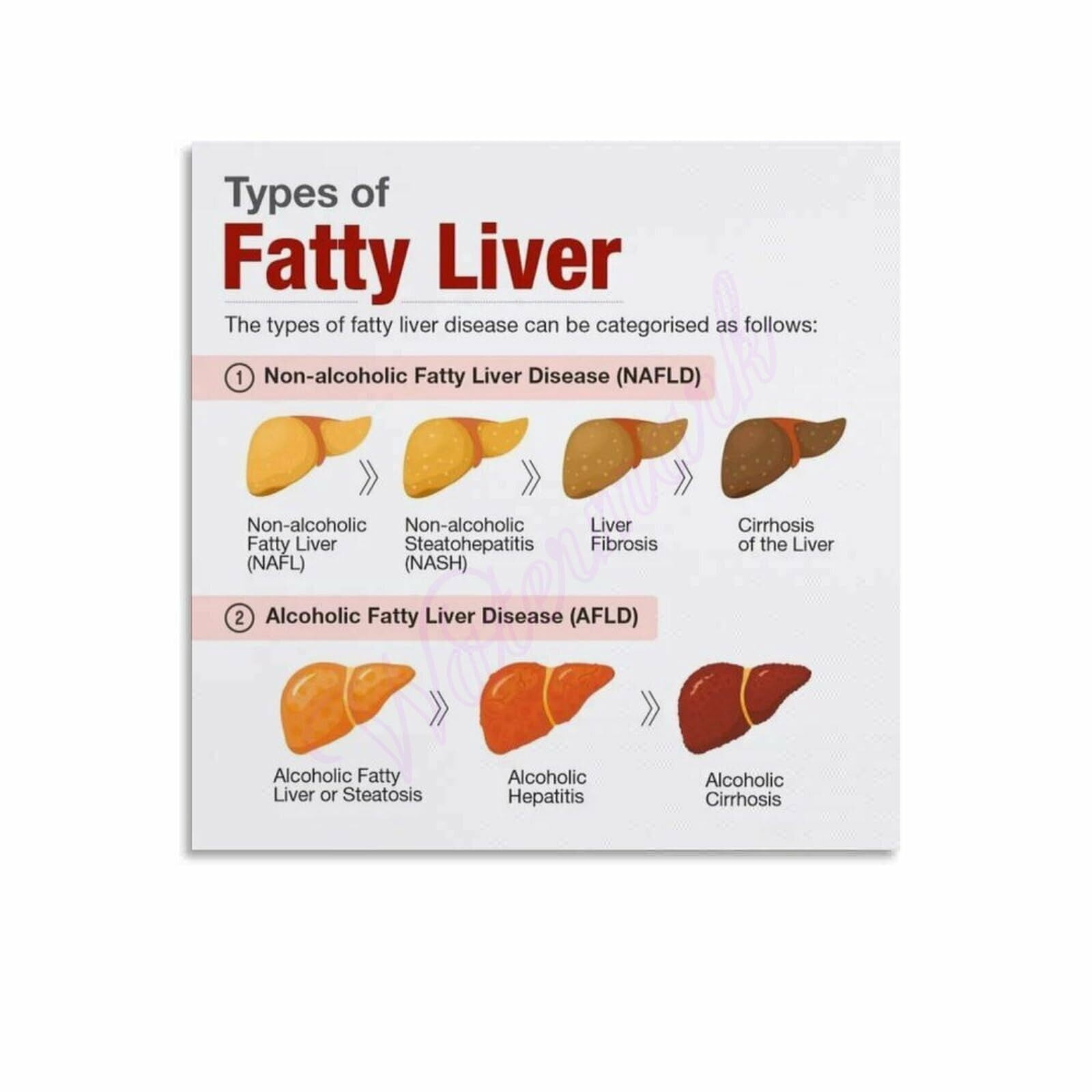 Fatty Liver Symptoms, Grade, Causes, Complications, Prevention Canvas ...