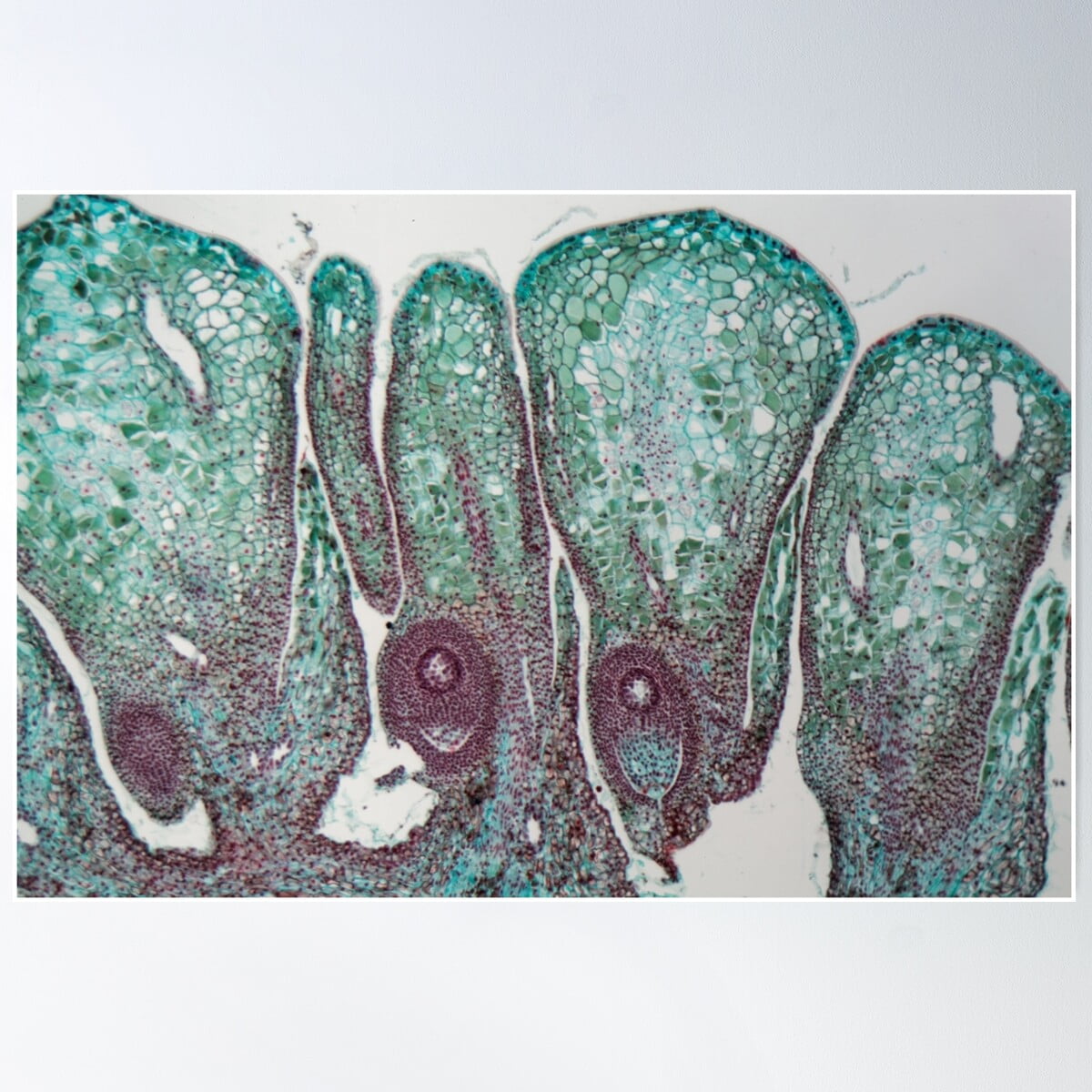 Female Pine Cone Under The Microscope Poster Wall Art, Modern Wall ...