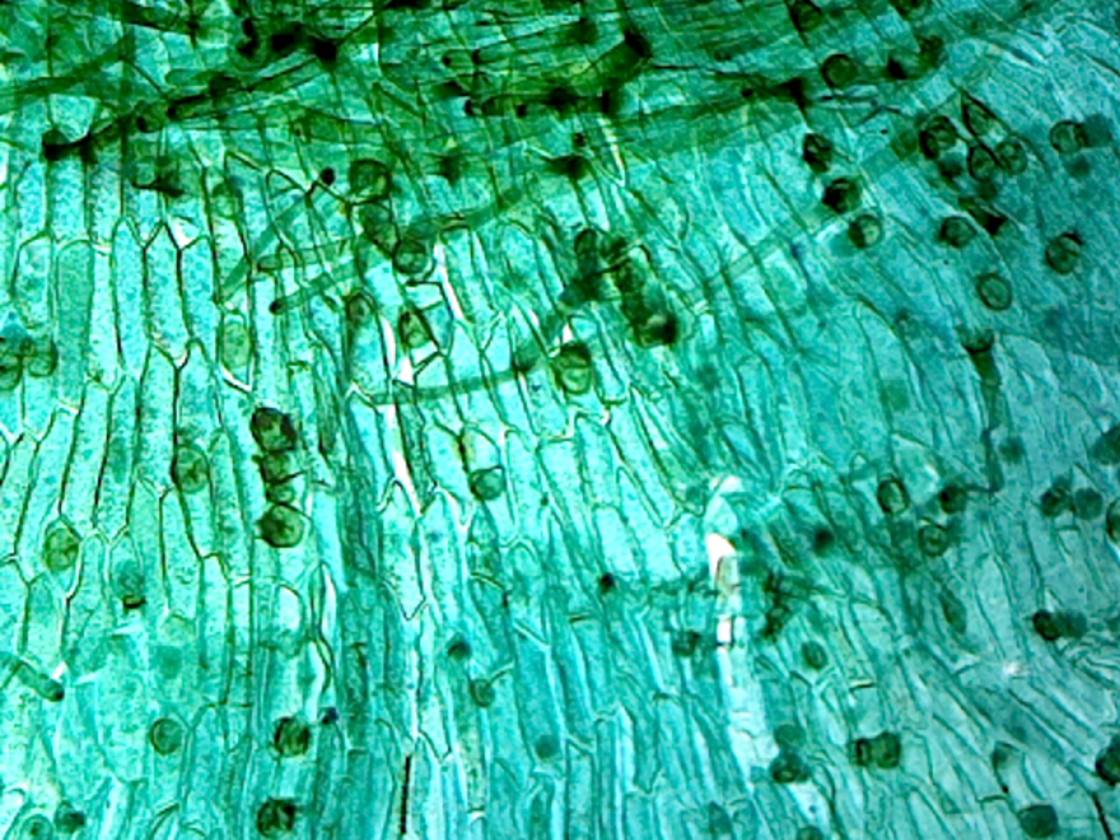 Fern (Pteridophyta) Filamentous Prothallium; Showing Germinating Spores ...