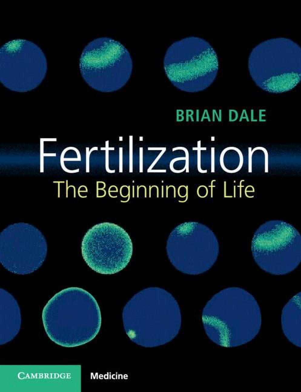 Fertilization: The Beginning of Life, (Paperback) - Walmart.com