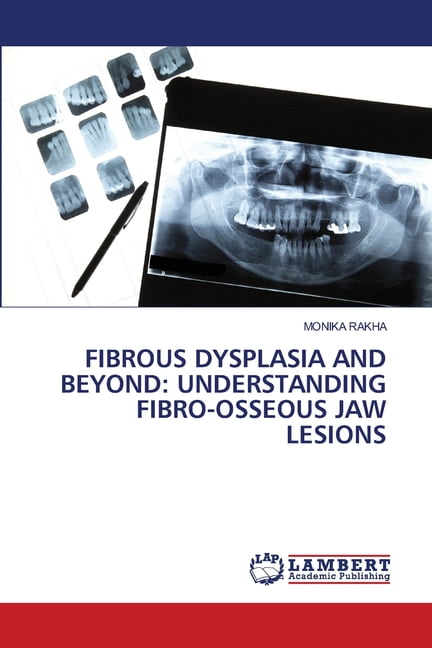 Fibrous Dysplasia and Beyond: Understanding Fibro-Osseous Jaw Lesions ...