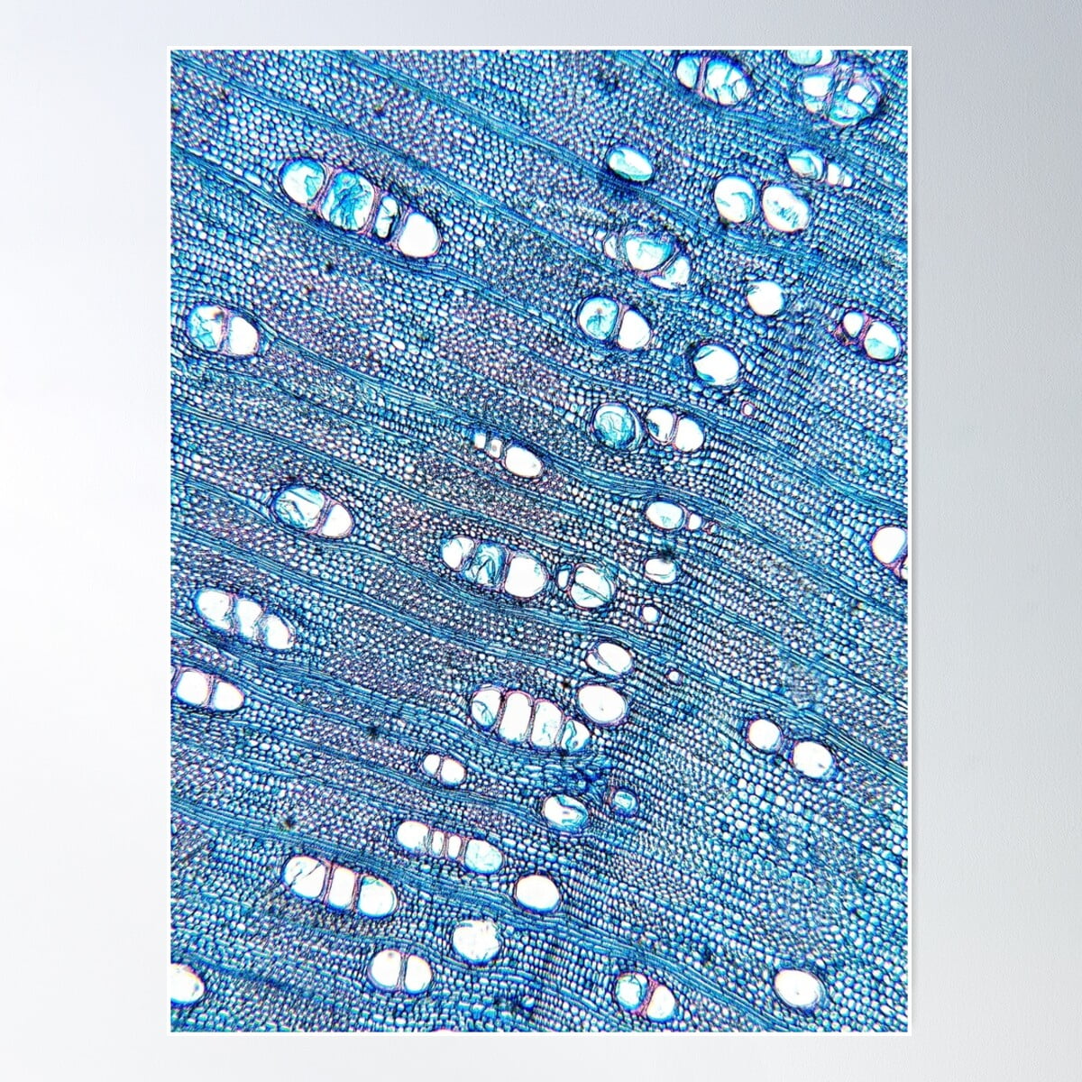 Fig Tree, Wood Cells, Cross Section; Plant Anatomy, Microscopy Poster ...