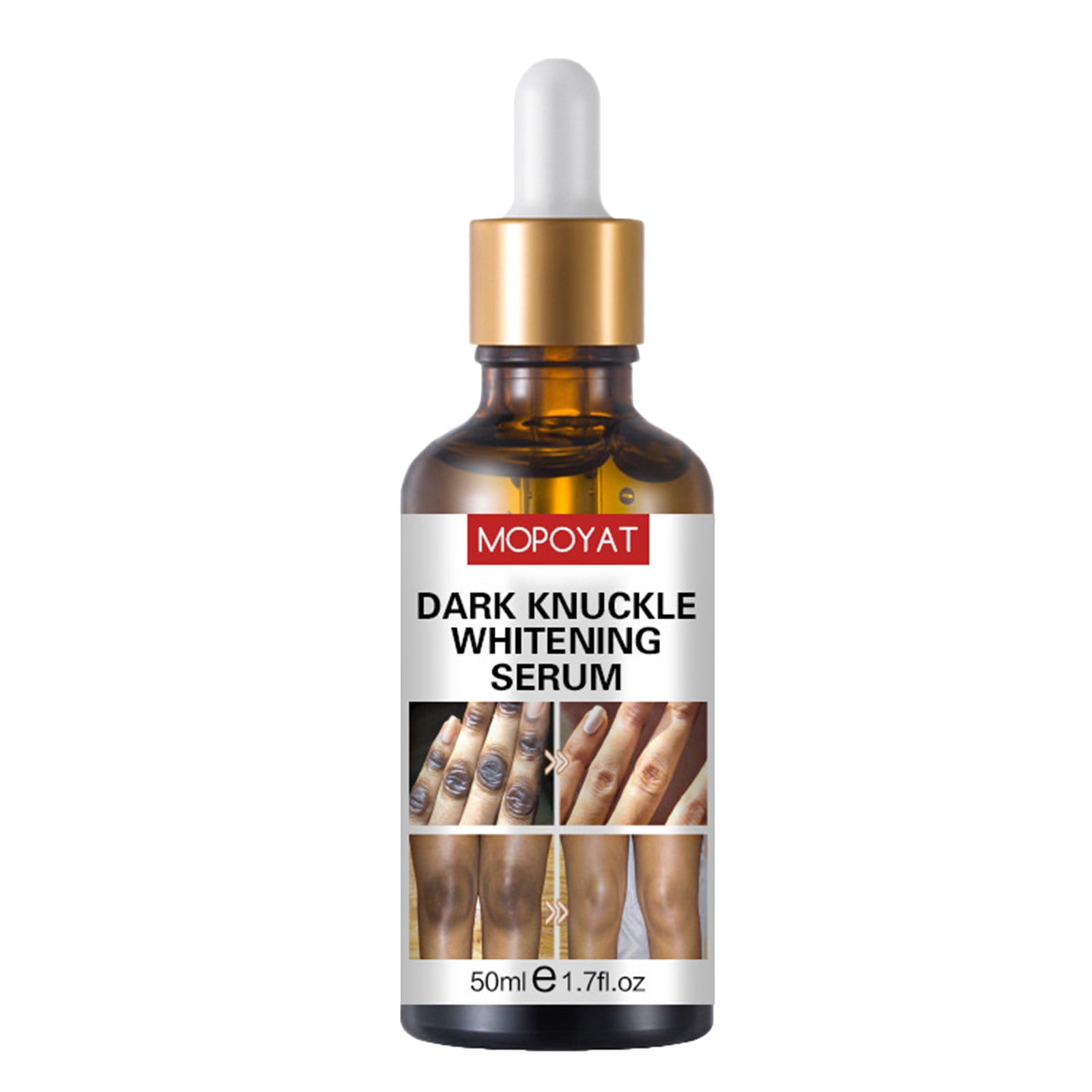 Finger Joints Brighting The Essence Dark Knuckles Whitening Serum 50Ml ...