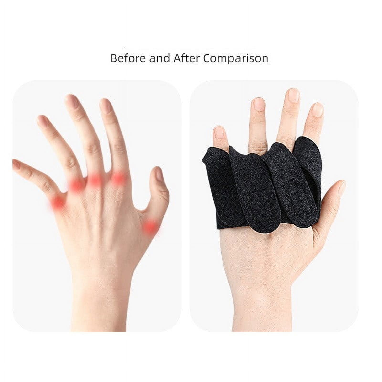 Finger Protection & Relief Set - Deviation & Drift Finger Clips, Split ...