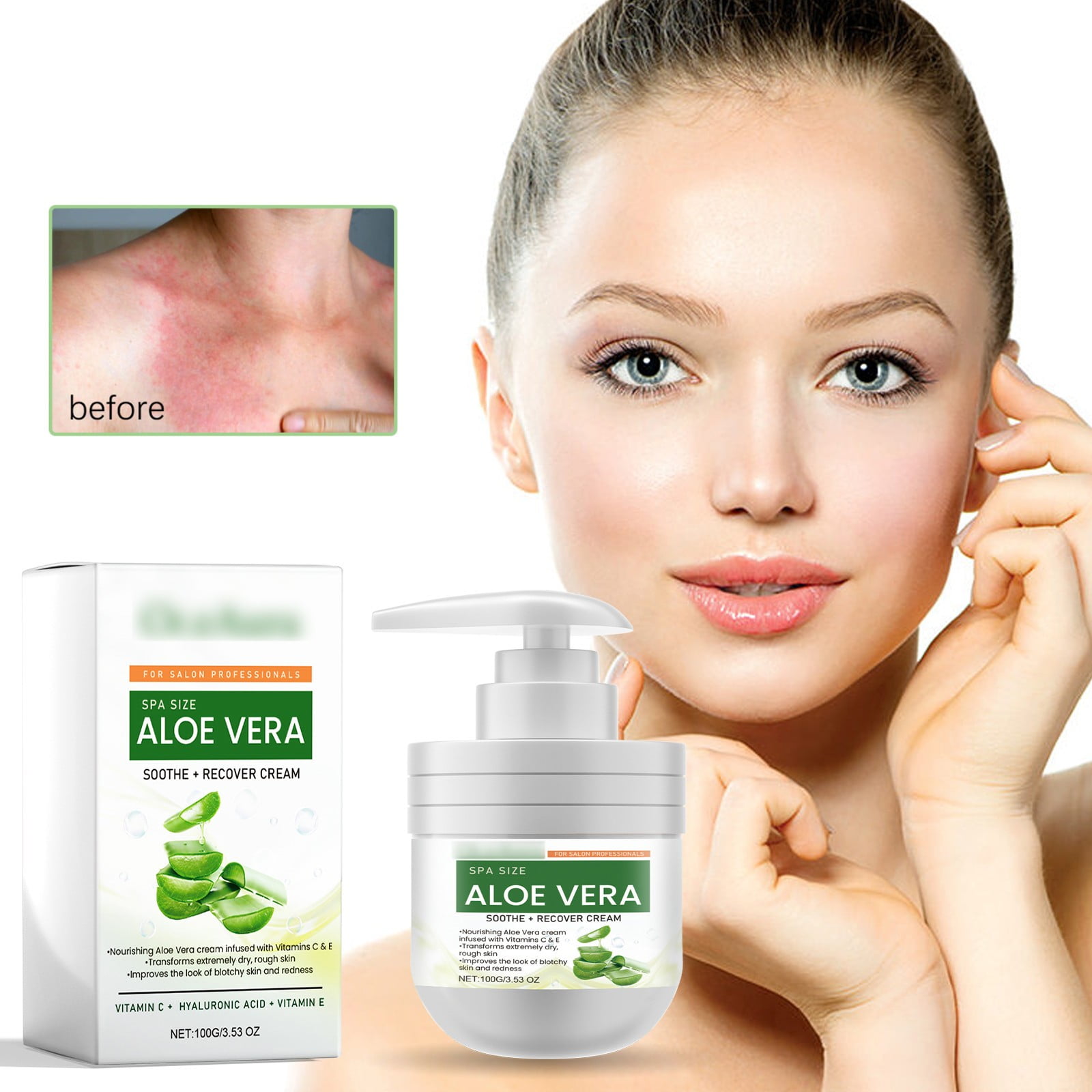 First Aid Repair After Sun Aloe Vera Gel for Sunburn Face Moisturizer ...