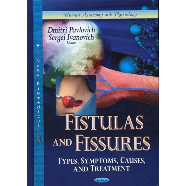 Fistulas and Fissures : Types, Symptoms, Causes, and Treatment - Walmart.com