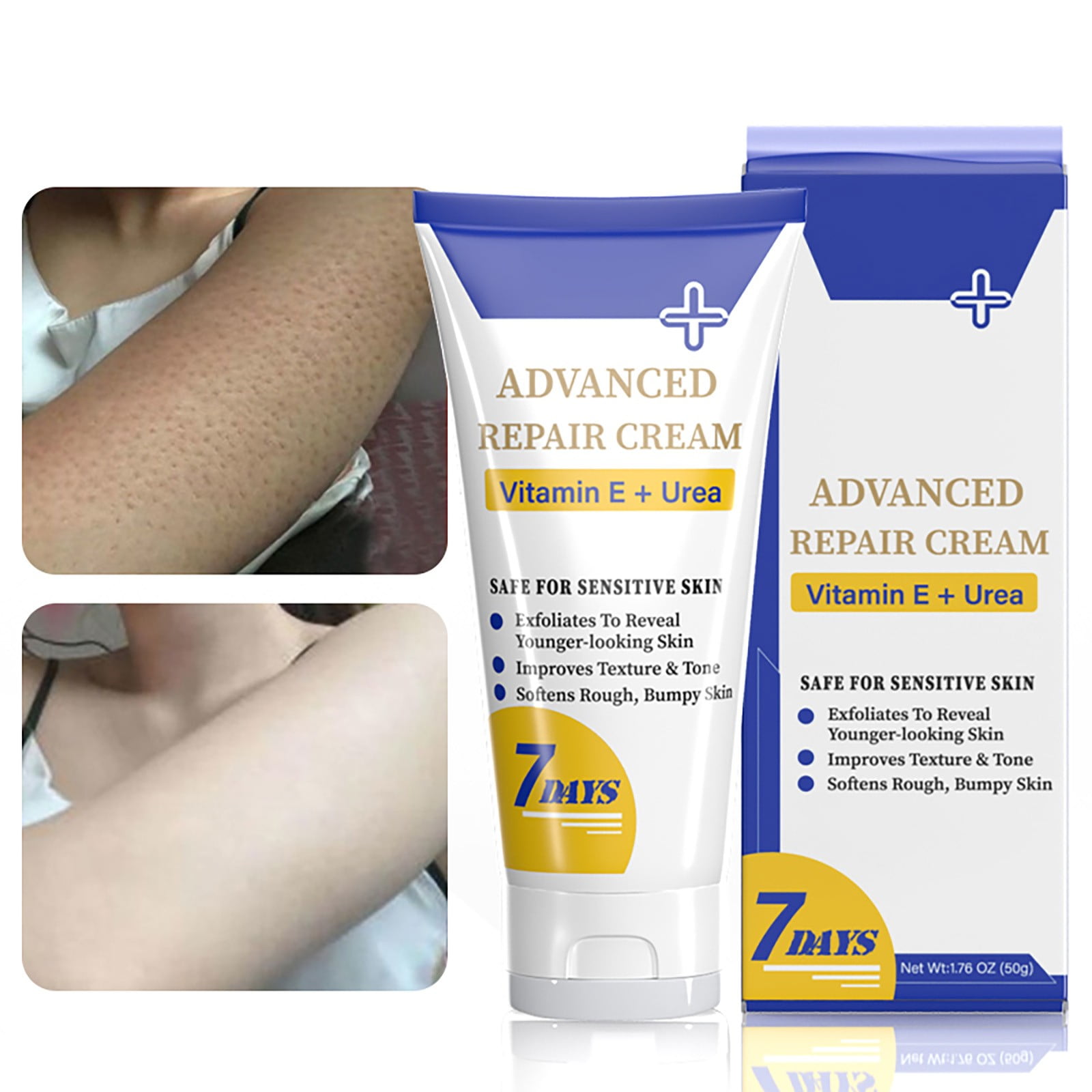 Flash Sale Clearance! Keratosis Keratosis Moisturizing Strawberry Legs ...