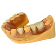 Flexible Flipper – Custom Acrylic & Flexible Options for Up to 3 ...