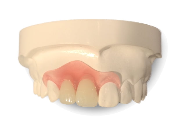 Flipper | Partial Denture - Walmart.com