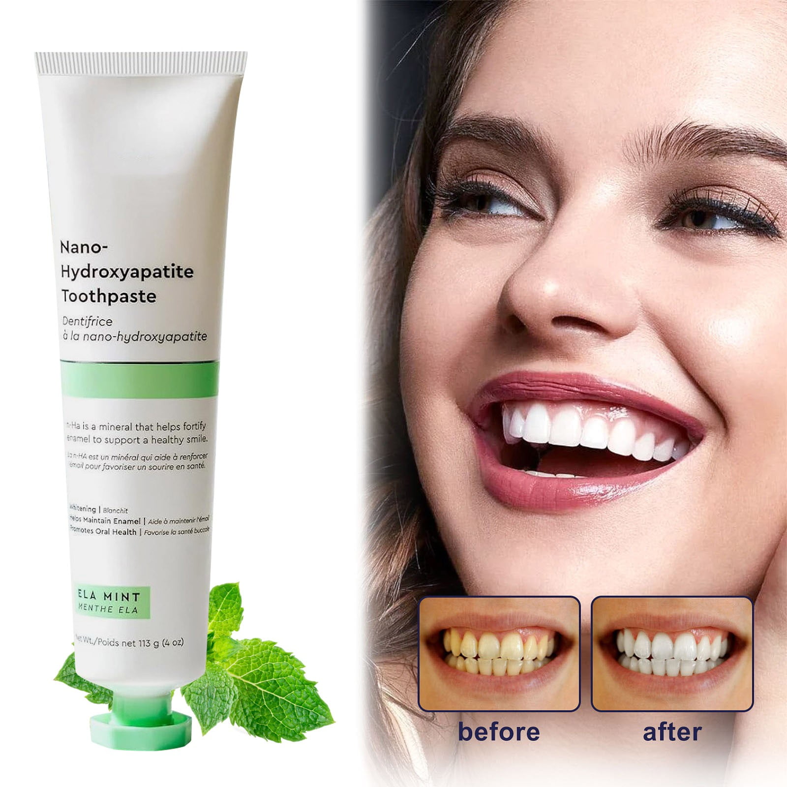 Fluoride-Free Nano Hydroxyapatite Toothpaste for Whitening ...