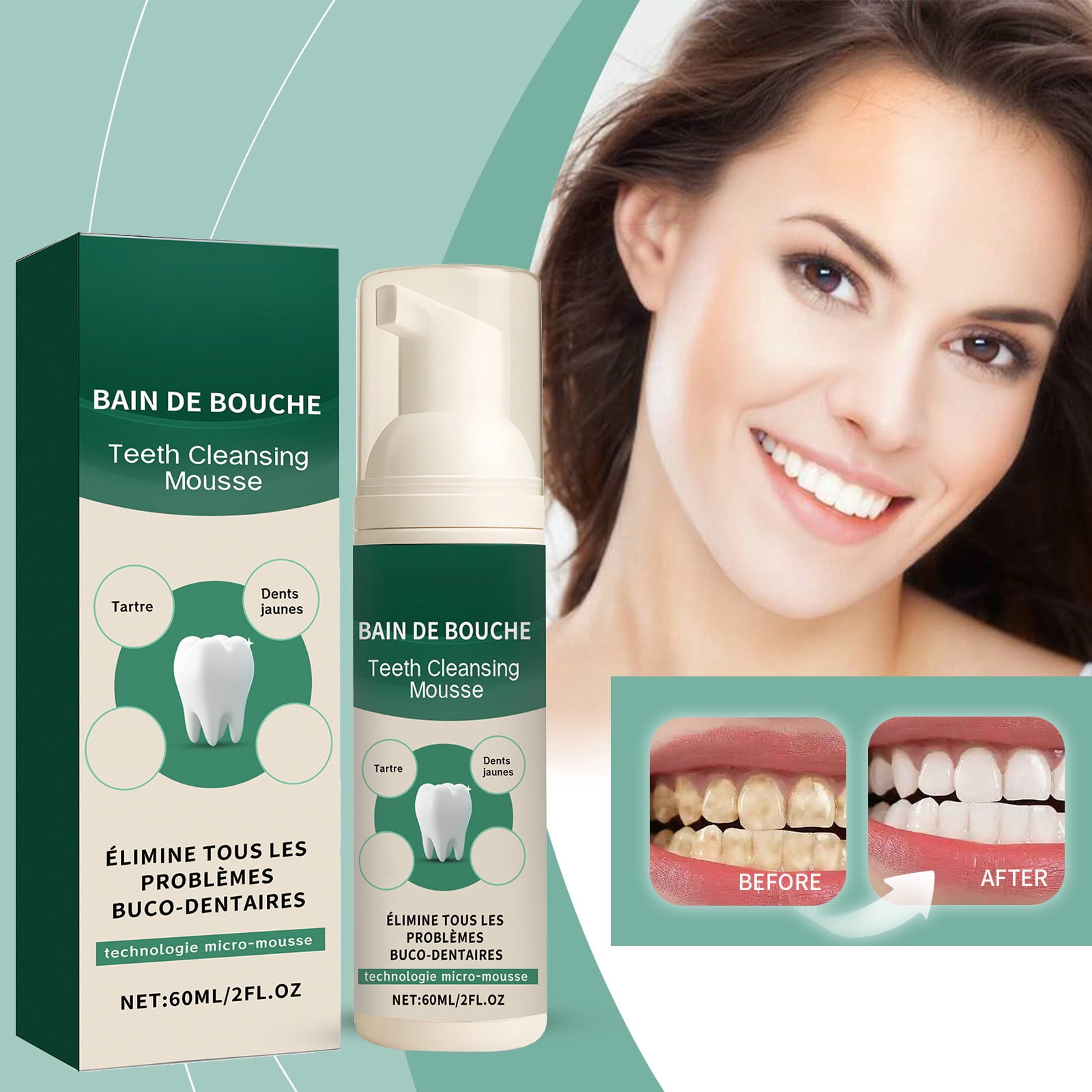 Foam Tooth Cleaning Mousse for Fresh Breath and Oral Cleaning Care ...