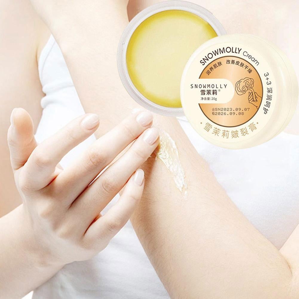 Foot Cracking Cream, Chapping Cream, Hand & Foot Antifreeze, Heel ...