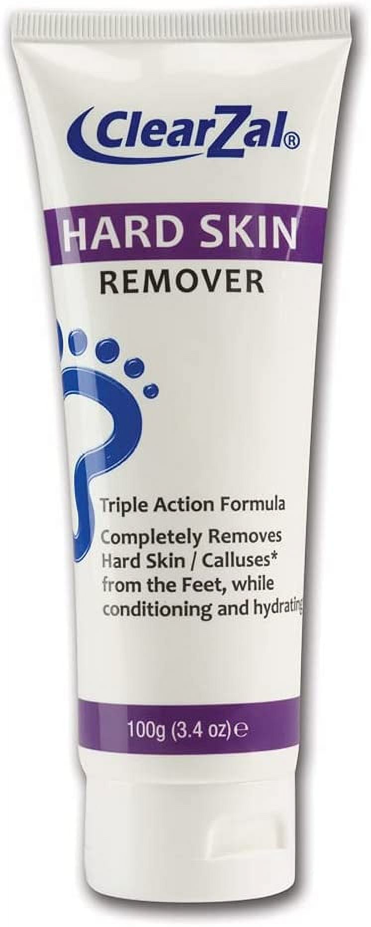 Foot Cream For Hard Skin, Helps Calluses and Corn Removal While Leaving ...