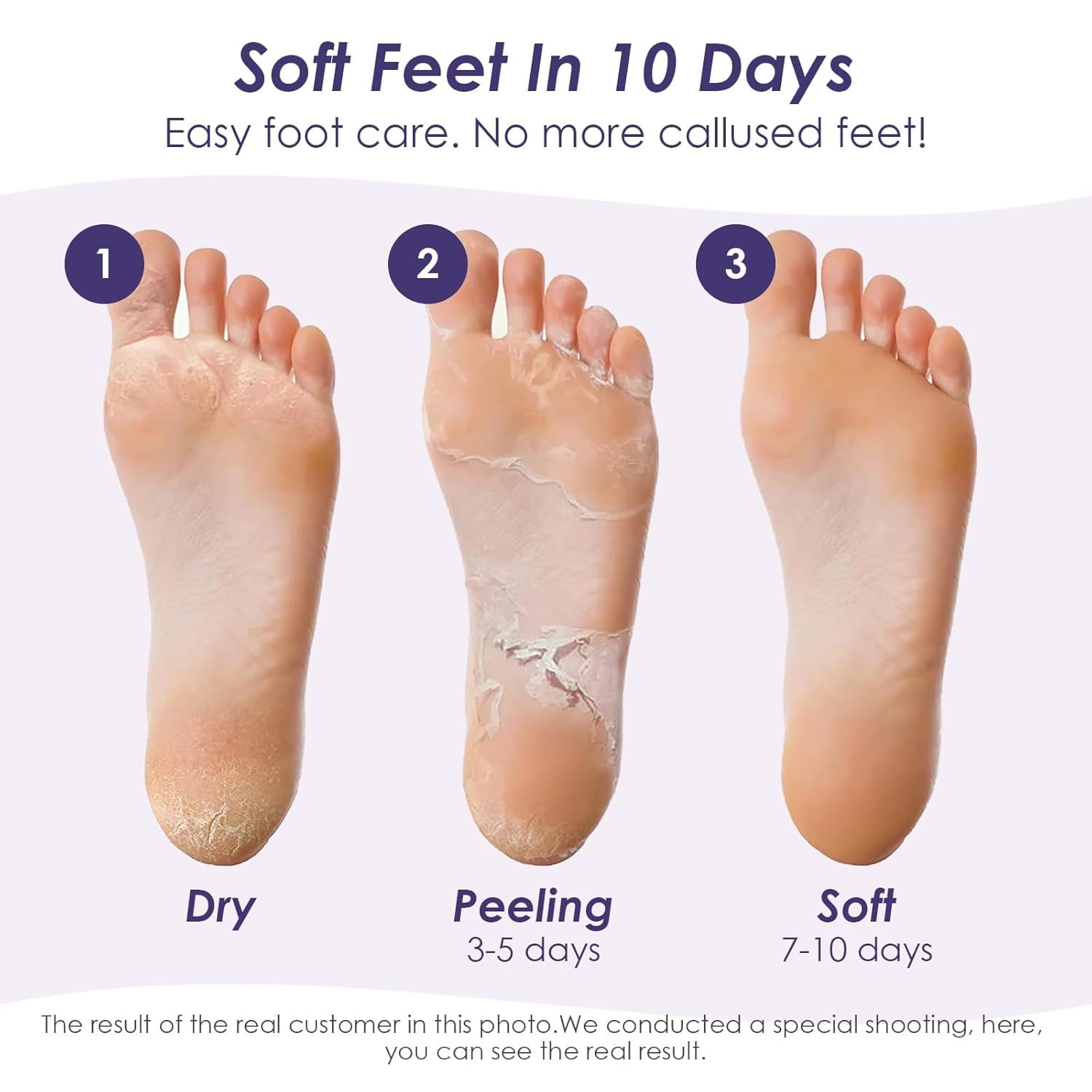 Foot Mask, Callus Socks, Dead and Effectively Removes Moisturising Foot ...