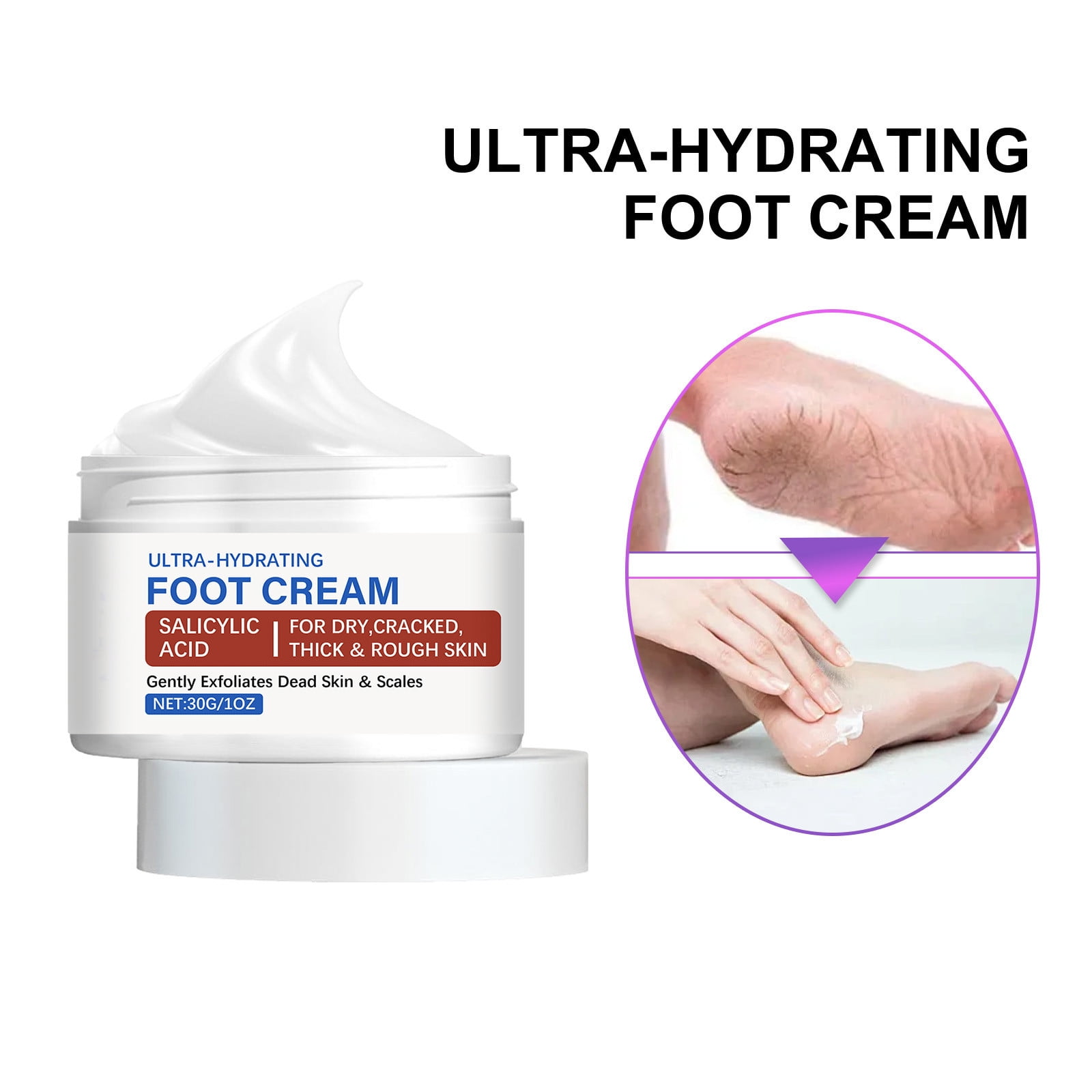 Foot Moisturizing Repair Cream, Deeply Hydrates, Repairs Dryness ...