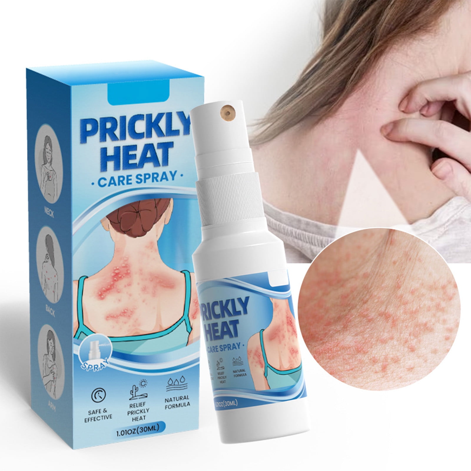 Foot Nursing Heat Rash Spray, Quick Relief Of Itching 30ml for Men and ...