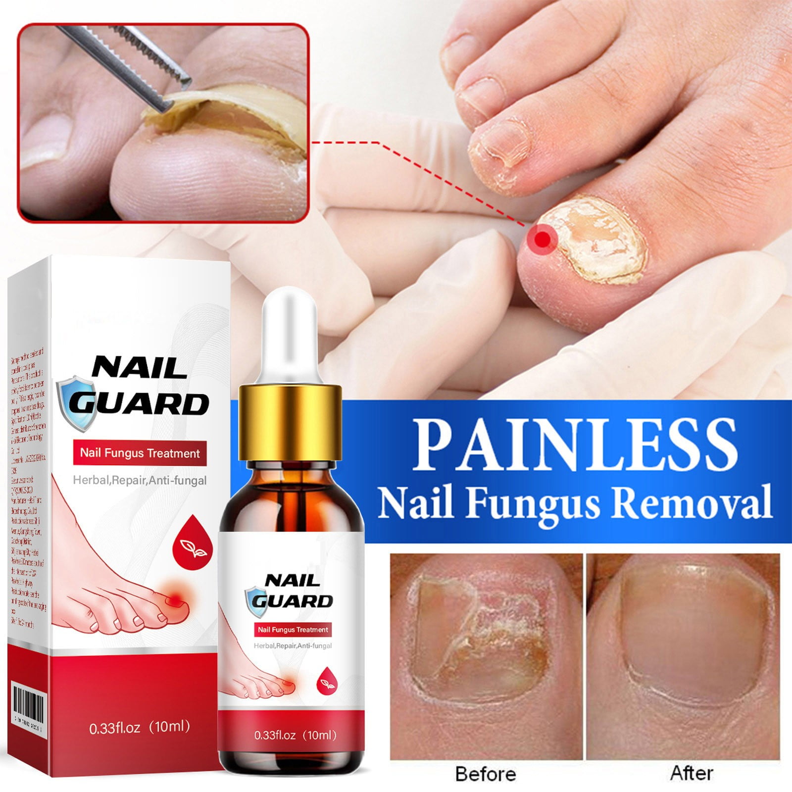 Foot Relief Treatment Toenail Fungal Super Strong, Nail Care, Nail Care ...