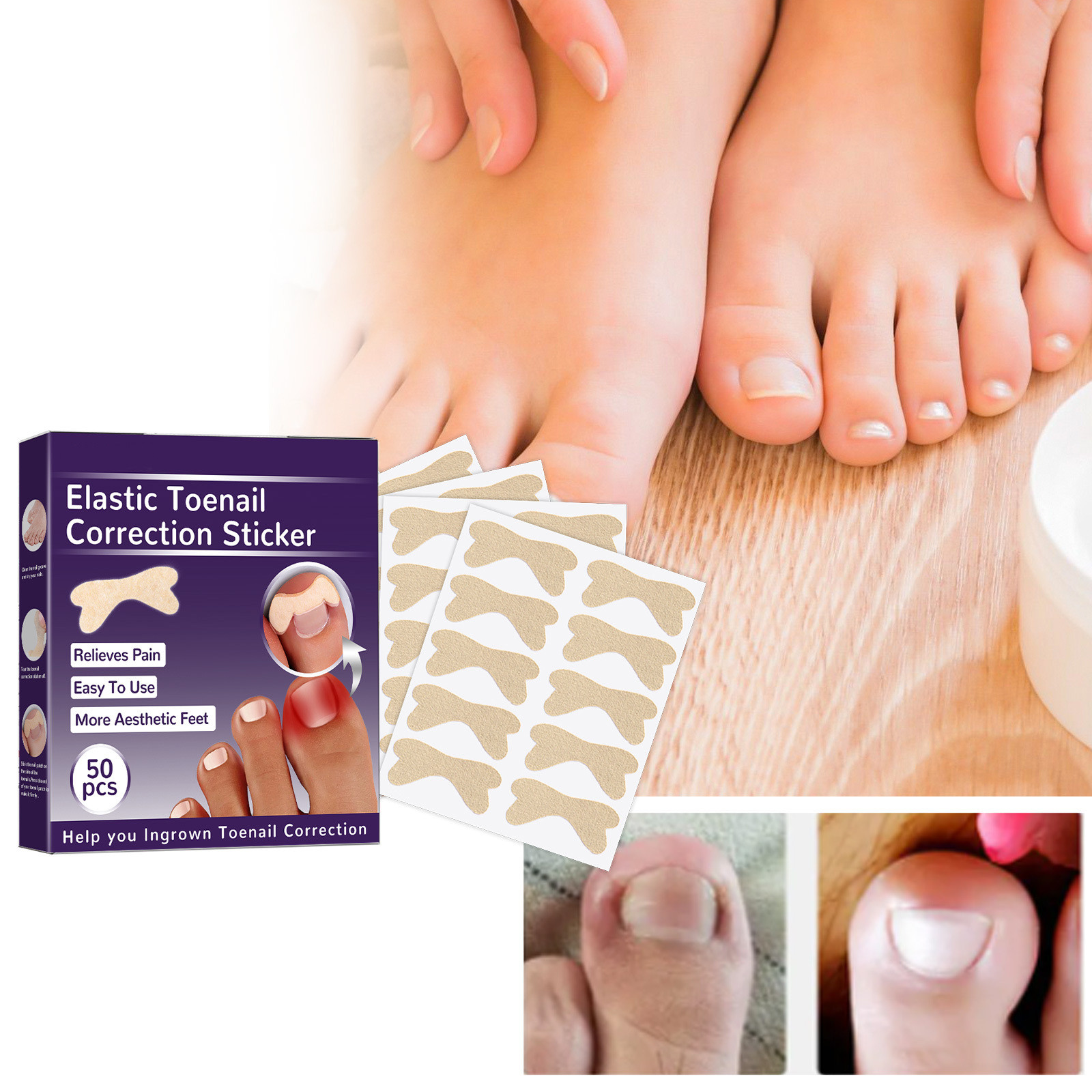 Foot Relief Treatment Toenail Fungus Patch, FastActing Nail Care Patch ...