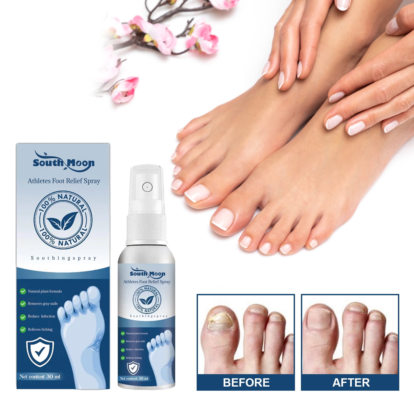 Foot Spray Relieves Foot Sweat, Itchy Feet, Peeling, Nail Fungus, Foot ...