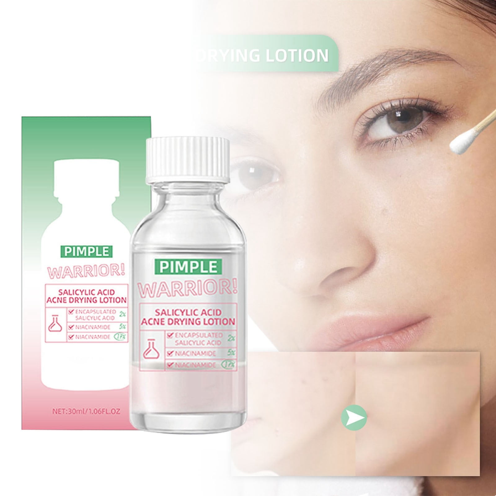 For Dry Dull Skin Minimizing Pore Quickly Redness And Swelling Swept