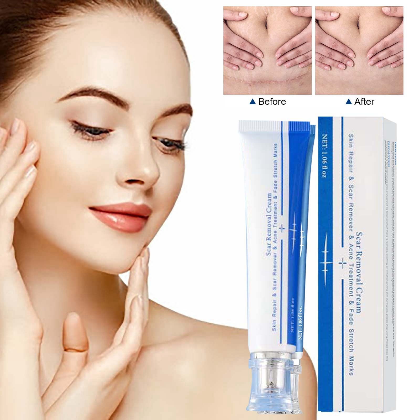 For Dry Sensitive Skin Brightening&Firming Scar Gel Advanced ... For Dry Sensitive Skin Brightening&Firming Scar Gel Advanced ...